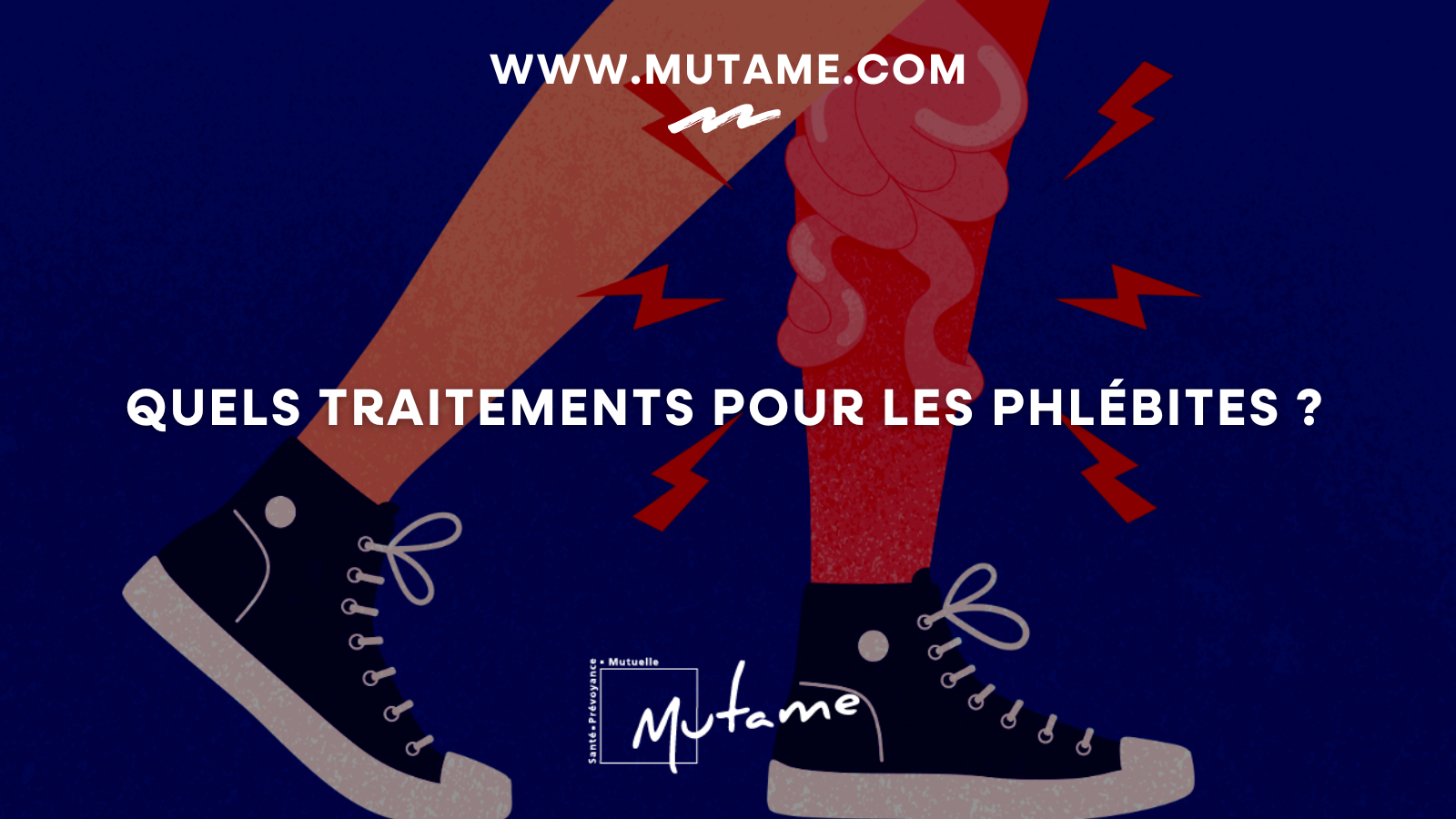 Comment reconnaître la phlébite et la soigner ? - Union Mutame