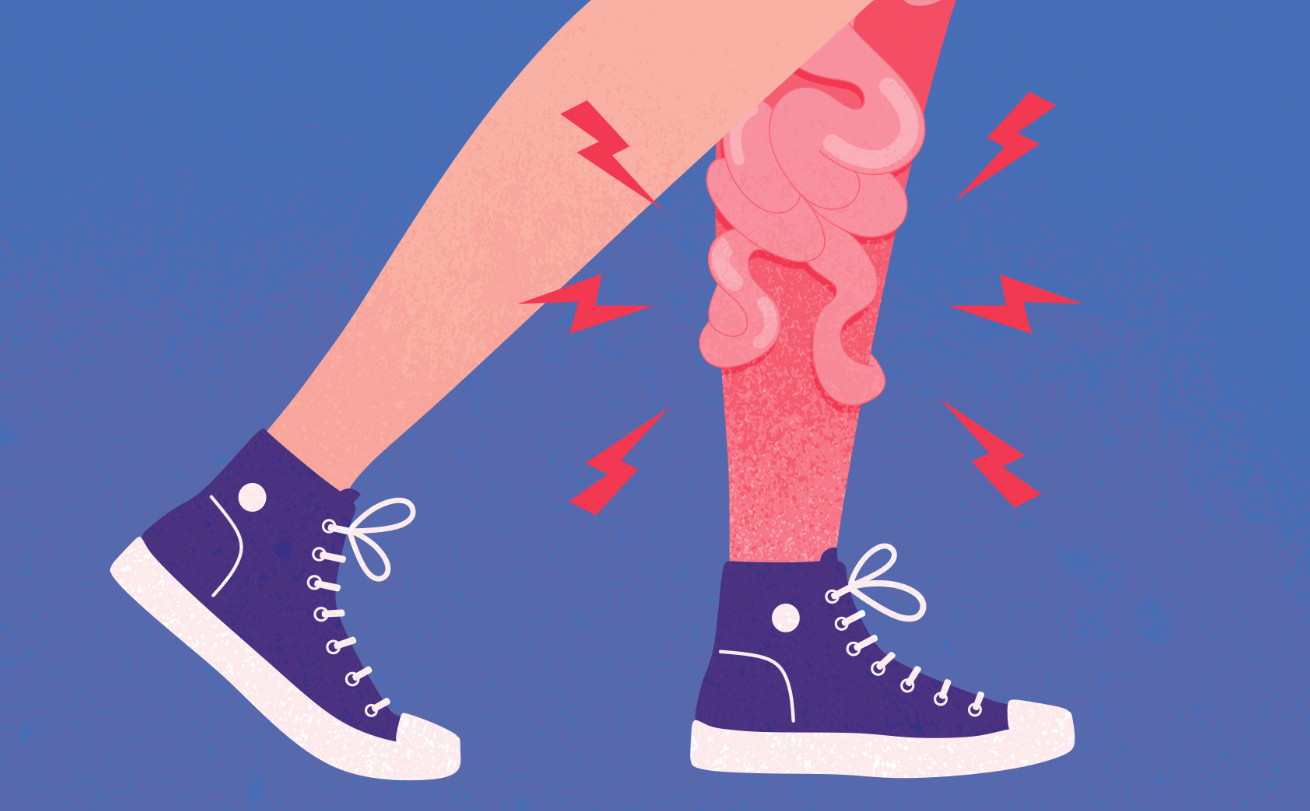 Comment reconnaître la phlébite et la soigner ? - Union Mutame