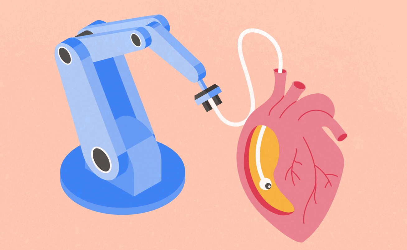 La chirurgie mini-invasive, une technologie à la pointe - Union Mutame