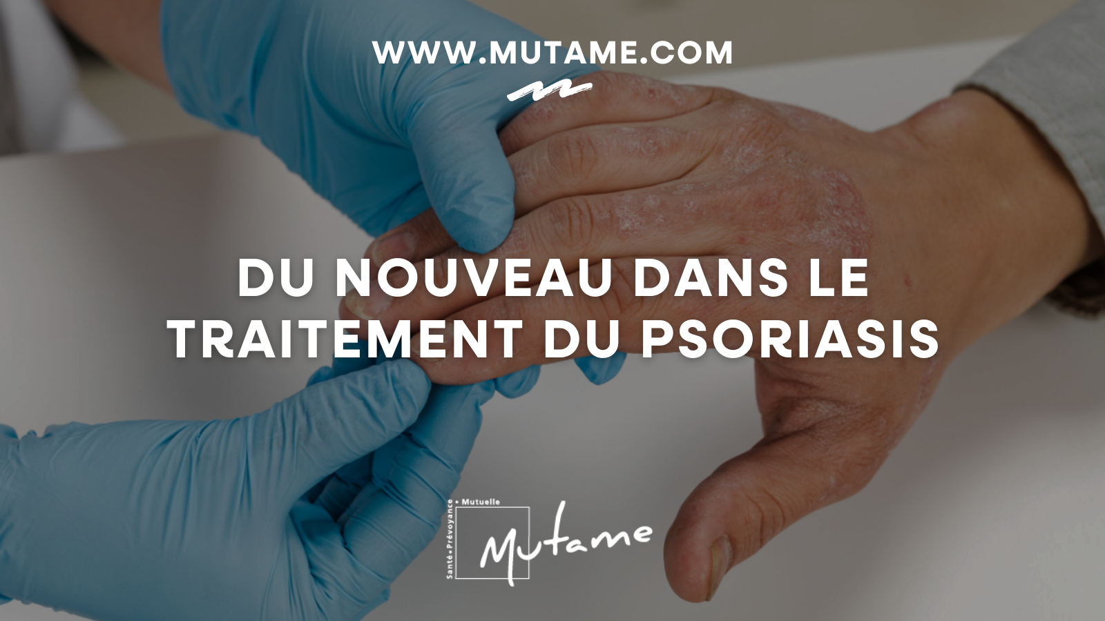 Une piste dans le traitement du psoriasis - Union Mutame